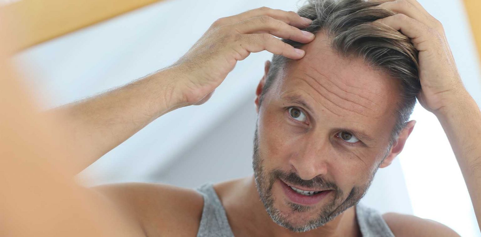 Receding Hairline: How To Reclaim Your Hair - Vera Clinic