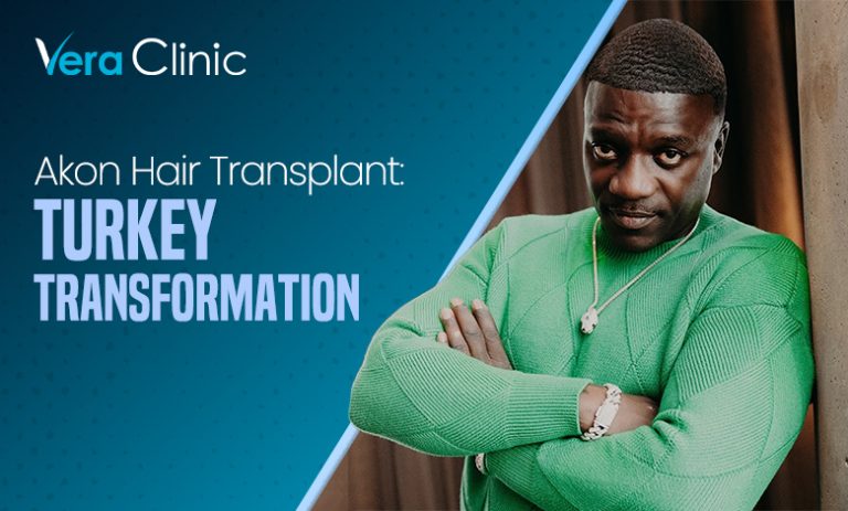 Akon Hair Transplant - Vera Clinic