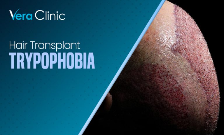 Hair Transplant Trypophobia - Vera Clinic