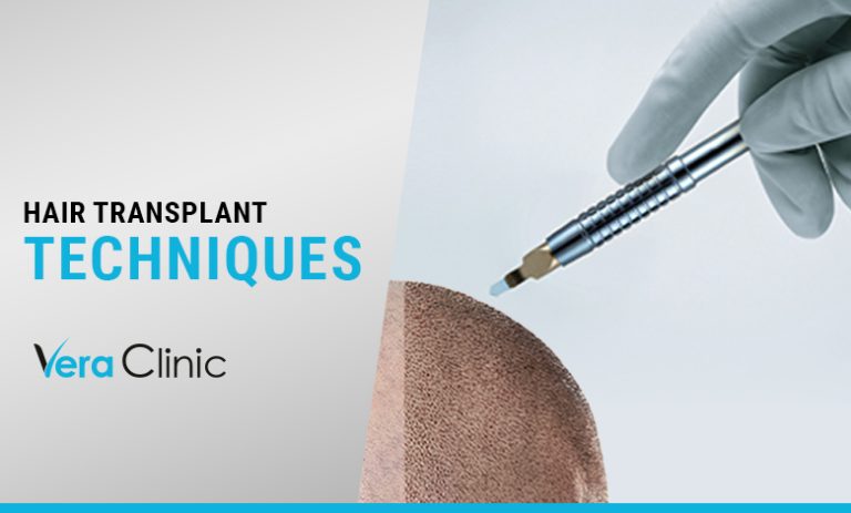 Hair Transplant Techniques - Vera Clinic