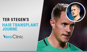 Ter Stegen’s Hair Transplant Journey - Vera Clinic