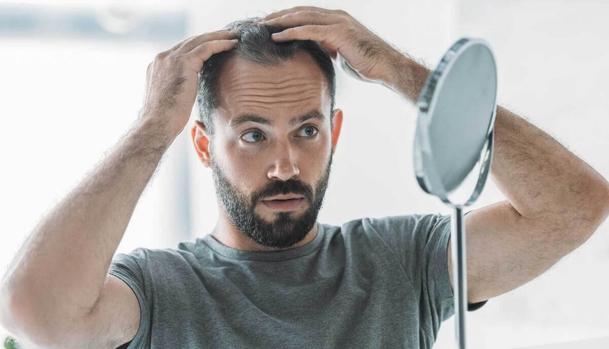 4 Tratamientos para la Pérdida del Cabello - Vera Clinic