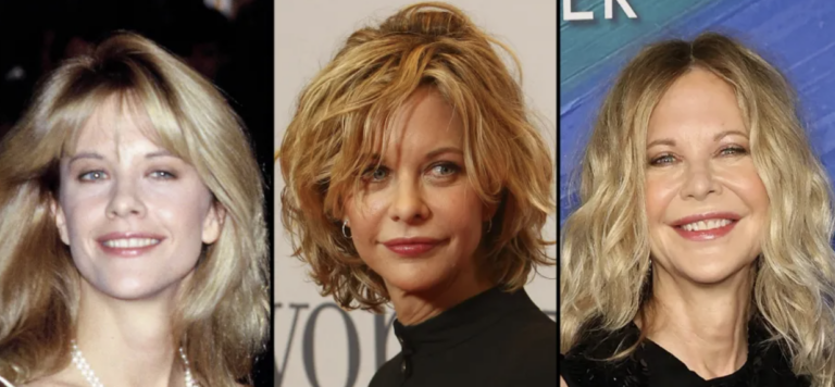 Meg Ryan Plastic Surgery: The Journey of Her Transformation
