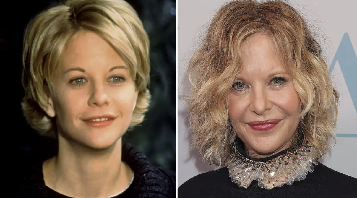 Meg Ryan Plastic Surgery: The Journey of Her Transformation