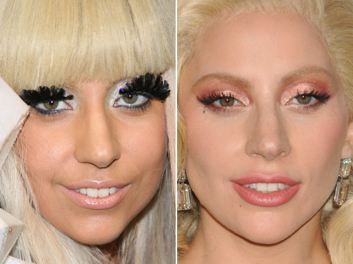 Lady Gaga Plastic Surgery: Unveiling the Transformation