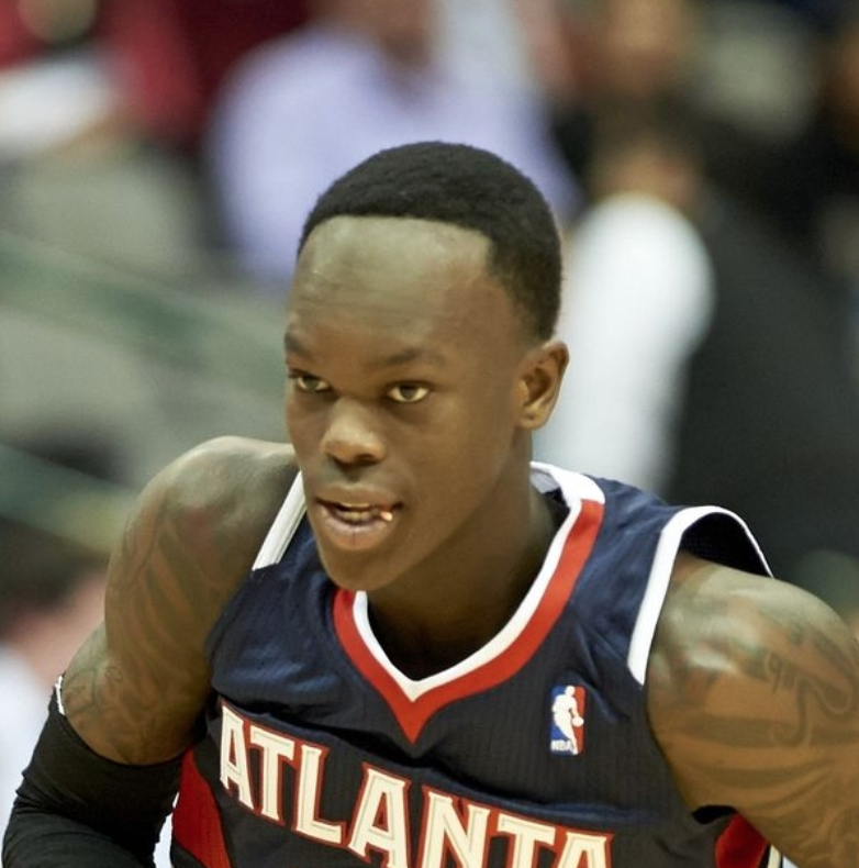 Dennis Schroder Hairline All Details