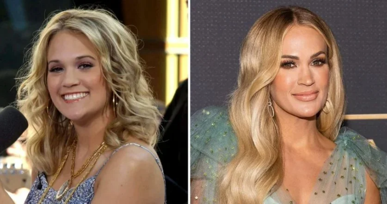 Carrie Underwood Plastic Surgery: A Detailed Analysis