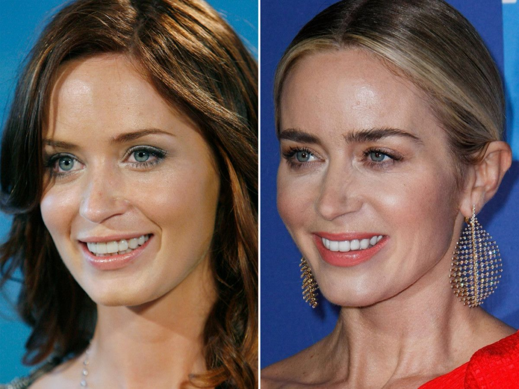 Emily Blunt Plastic Surgery: Fact or Fiction?