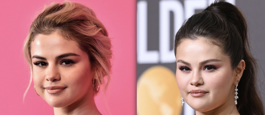 Selena Gomez Plastic Surgery: The Truth Behind Rumors