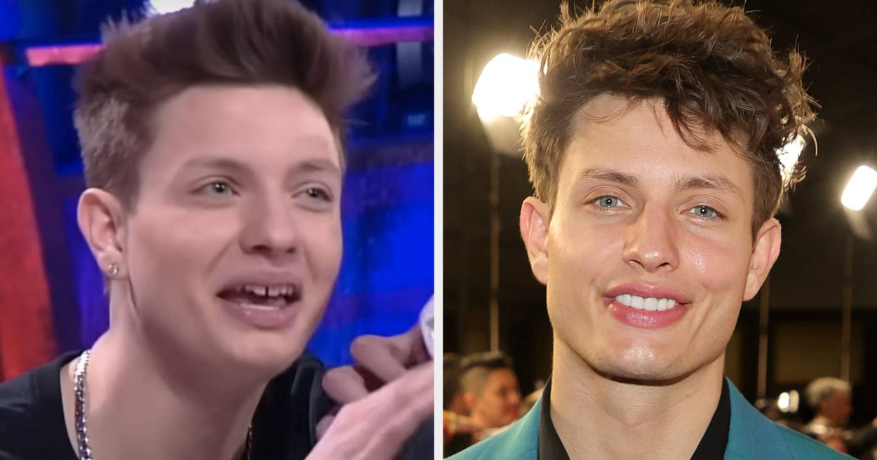 Matt Rife Plastic Surgery: A Deep Dive into Rumors
