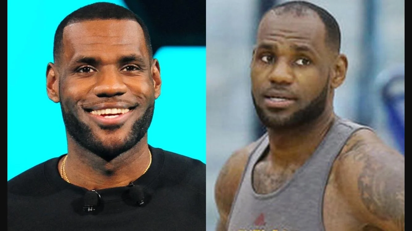 LeBron James Hairline: Before, After, and Everything In Between