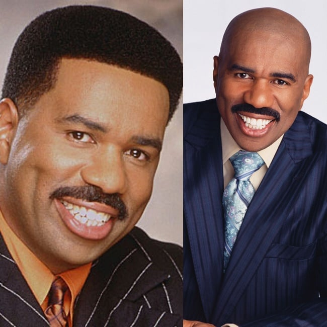 Steve Harvey Hairline: The Iconic Transformation