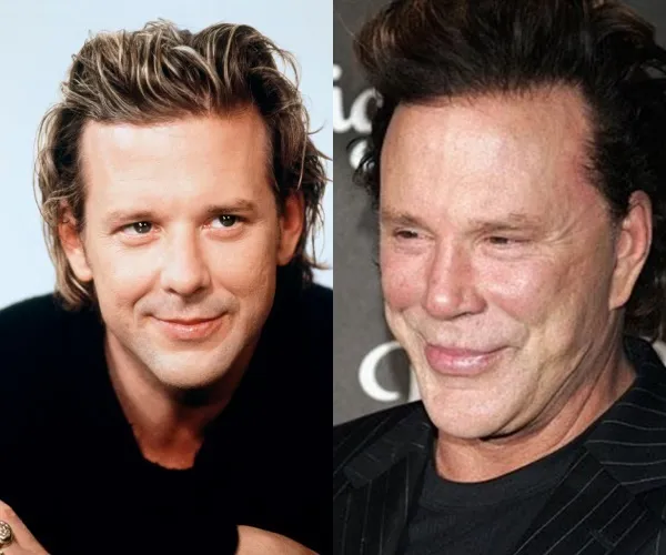 Mickey Rourke Plastic Surgery: A Comparative Analysis