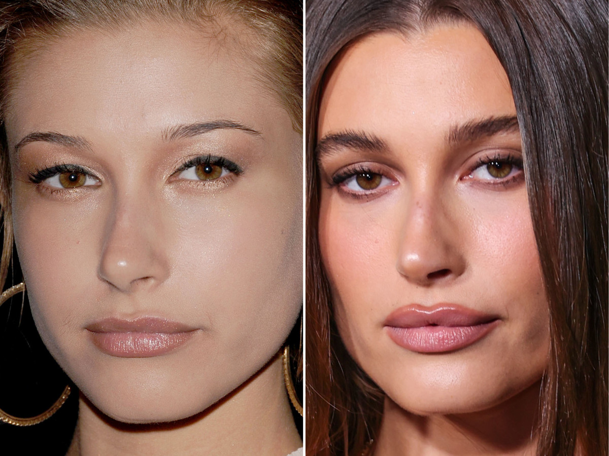 Hailey Bieber Plastic Surgery: The Evolution of Beauty Hailey Bieber Plastic Surgery: The Evolution of Beauty