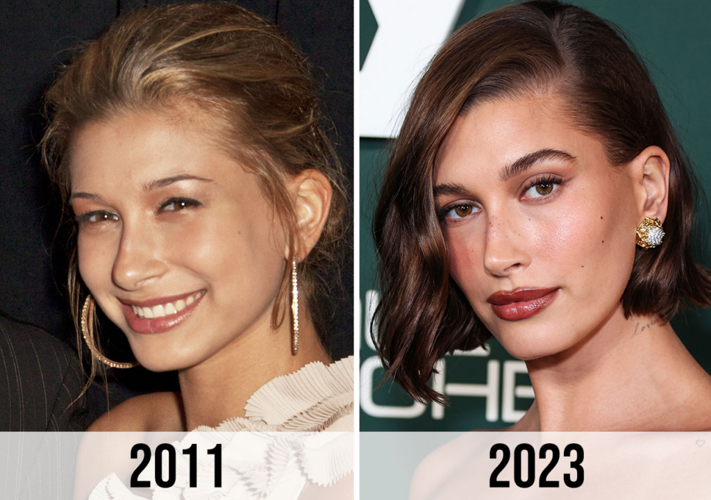 Hailey Bieber Plastic Surgery: The Evolution of Beauty Hailey Bieber Plastic Surgery: The Evolution of Beauty
