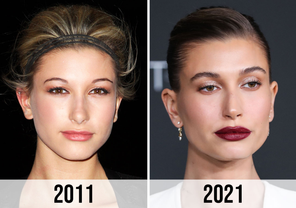 Hailey Bieber Plastic Surgery: The Evolution of Beauty