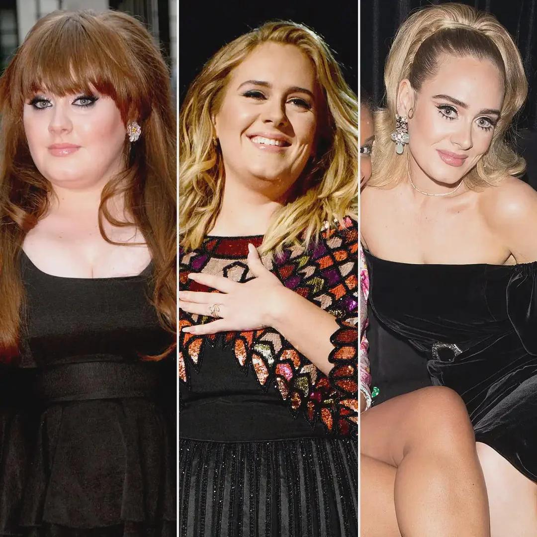 Adele Plastic Surgery: Exploring the Rumors