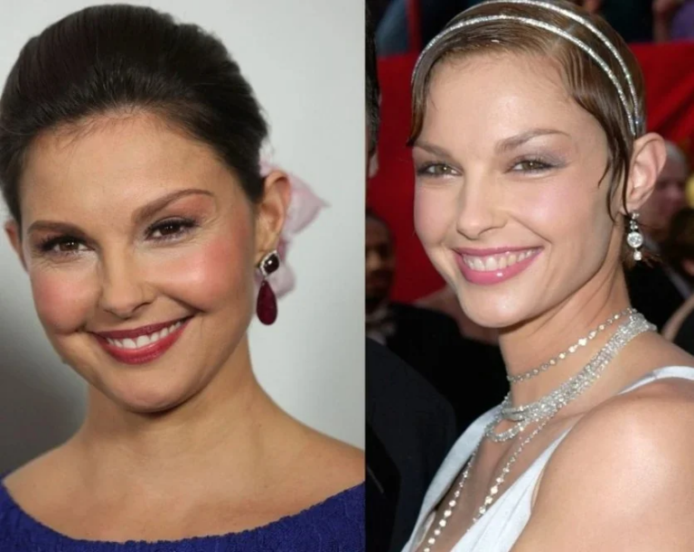 Ashley Judd Plastic Surgery: A Comprehensive Analysis